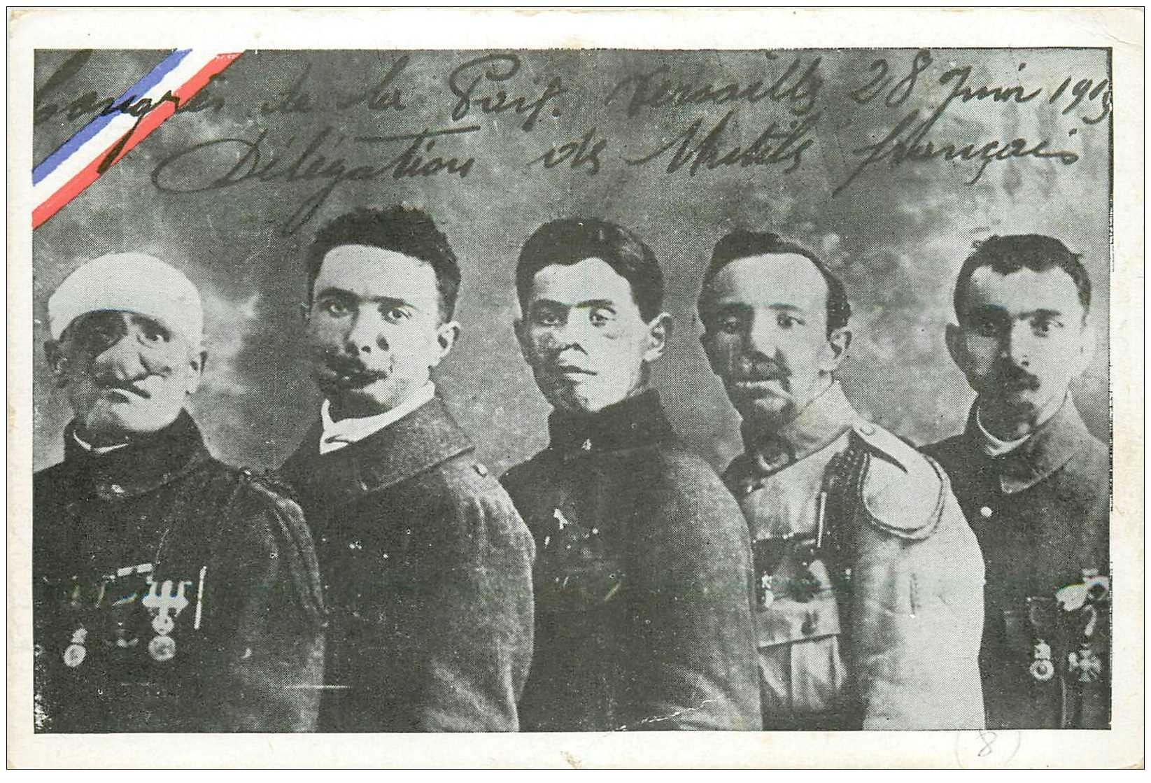 Guerre 1914-1918. LES GUEULES CASSEES. Aidez les Blessés de la face Guerre 1914-1918. LES GUEULES CASSEES. Aidez les Blessés de la face